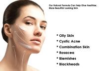 China Natural Repairing Soothing Unscented Face Moisturizer Skin Care for sale