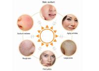 China ODM Aloe Vera Gel After Sun Lotion For Face Body Soothing for sale