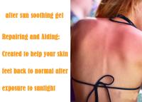 China OEM After Sun Gel Soothe Hydrate Sunburn Pain Relief for sale