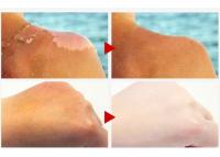 China Moisturizing 100ml After Sun Care With Aloe Vera Gel Sunburn for sale