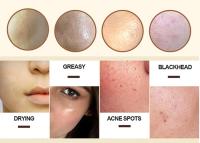 China Unscented Hydrating Daily Facial Cleanser For Sensitive Skin for sale
