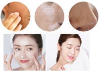 China Oil Free Gentle Deep Pore 100ml Face Cleanser Skin Care for sale