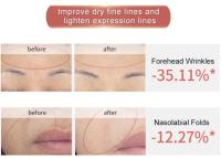 China Anti Aging Whitening Hyaluronic Acid Face Serum Oils For Fine Line for sale