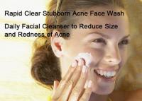 China Whitening Vitamin C Oil Control Face Cleanser To Help Minimize Pores for sale