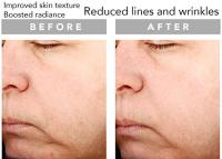 China Custom Volume Brightening Face Serum Oils Skin Revitalizer for sale