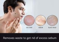 China Anti Aging Detoxifying Exfoliating Face Scrub For Dry Skin Lightening for sale