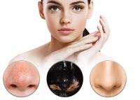 China 100ml Deep Cleansing Peel Off Mask Reduces Acne Smoothing Skin for sale