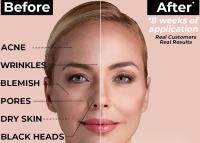 China GMP Collagen Clay Face Mask With Vitamin C Reduces Wrinkles Brightens Skin for sale