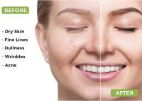 China ODM Green Tea Clay Mud Mask Deep Washing 3 Years Shelf Life for sale