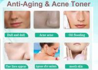 China FDA Vitamin C Toner Brightening Cleansing Softening Removes Pore Clogging Residue for sale