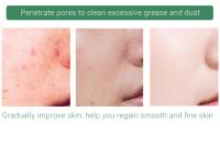China GMP Exfoliating Face Scrub Peeling Cream Mild Smooth Skin Natural Extract for sale