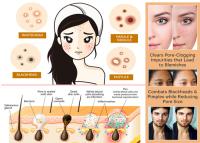 China Customized 2oz Vitamin C Face Scrub Exfoliator Blackhead Reducing for sale