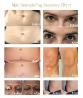 China Semi Permanent Pmu Pigment Ink White Freckles Vitiligo Skin Remodeling for sale