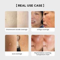 China Custom Vitiligo Camouflage Ink Skin Tone Tattoo Stretch Mark Pigments for sale