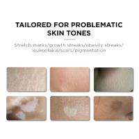 China PMU Micro Skin Tone Ink Stretch Mark Camouflage Pigments for sale