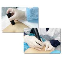 China Private Label Stretch Mark Vitiligo Pigment Kit Semi Permanent Skin Micropigmentation for sale