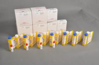 China RELA Clinical Diagnostic Reagents Hepatic Kits Chemistry Analyzer Reagents for sale