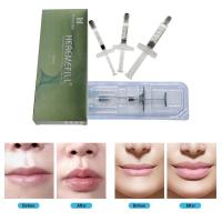 China 10ml 100ml 1ml 2ml Korean Acido Hialuronico Hyaluronic Acid Injectable Hyaluronate Korea Ha Dermal Filler For Lips for sale