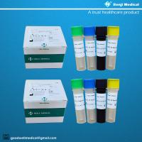 China Novel Coronavirus COVID-19 Nucleic Acid Testing Kit CE Qualitative Rt Pcr Test for sale