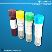 China 50 tests/kit Nucleic Acid Testing Kit , Coronavirus Detection Kit CE Certification for sale