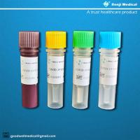 China DNA RNA Nucleic Acid Testing Kit With Real Time Fluorescent Quantitative PCR for sale