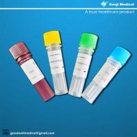 China Fluorescence Probing Nucleic Acid Testing Kit , RT-PCR Novel Coronavirus Test Rapid for sale