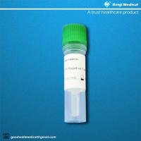 China COVID-19 Novel Coronavirus Test Kit high capacity testing MA YBTC approval for sale