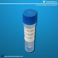 China 95% Sensitivity Sars-Cov-2 Home Test Kit Oropharyngeal Nasopharyngeal for sale