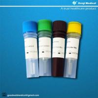 China MA SDS certificated Nucleic Acid Testing Kit Polymerase Chain Reaction PCR for sale