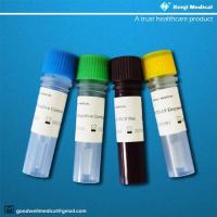 China 95% Sensitivity Nucleic Acid Testing Kit , 40-90 mins Rt Pcr Detection Kit for sale