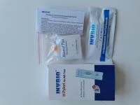 China Colloidal Gold Cholerae Rapid Test Kit O1 Antigen Diagnostic Cassette 25 Tests for sale