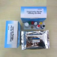 China odm Elisa Diagnostic Kit For Hepatitis B Virus Surface Antigen for sale