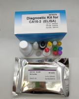 China CE Approved HBcAb IgM ELISA Test Kit One Step Medical Diagnostic Device 96 Tests for sale