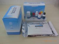 China CE Approved HBsAg ELISA Test Kit 96T Medical Diagnostic Device for Hepatitis B Screening for sale