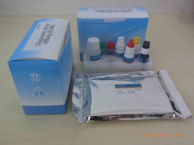 China CE Approved HBsAg ELISA Test Kit 96T Medical Diagnostic Device for Hepatitis B Screening for sale