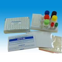China HAV IgM Elisa Test Kit Plate Human Use 96 Tests Per Box for sale
