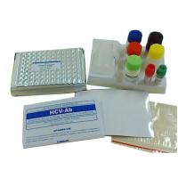 China Medical Diagnostics HBsAb Elisa Test Reagents OEM Packing for sale
