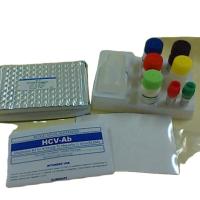China Interleukin 1 Beta elisa detection kit Human Il1b Elisa Kit Reaserch Use for sale
