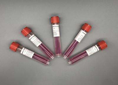 China ISO13485 Disposable Oral Throat Swab VTM Kit 3ml Virus Transport Medium for sale