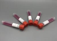 China Ethylene Oxide Sterilization VTM Disposable Virus Delivery Media for sale