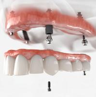 China 2.4 Ounces Implant Cases for Dental Sterilization Steam Sterilization for sale