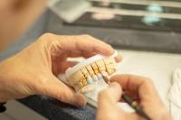 China High Durability Dental Implant Case Artificial Implantation Cases for Dental Professionals for sale