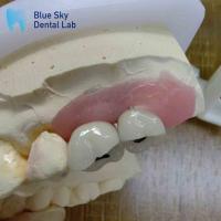 China Regular Implant Cases Universal Compatibility Dental Implant Case for sale