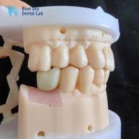 China Regular Implant Cases Universal Compatibility Dental Implant Case for sale