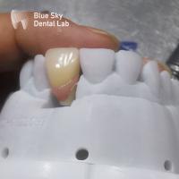 China Regular Implant Cases Universal Compatibility Dental Implant Case for sale