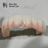 China Universal Multiple Choices Implant Cases Designed For Smooth Surface And Sterile Steam Cleaning for sale