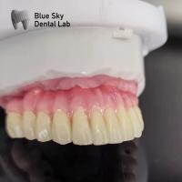 China Nature Dental Implant Cases Smooth Full Mouth Implant Case For Implant System for sale