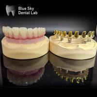 China Screw retained MUA abutment Implant Cases Zirconia crowns Multilayer pink porcelain with Easy repair for sale