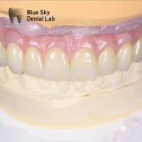 China Universal Multiple Choices Implant Cases Designed For Smooth Surface And Sterile Steam Cleaning for sale