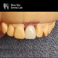 China Regular Implant Cases Universal Compatibility Dental Implant Case for sale